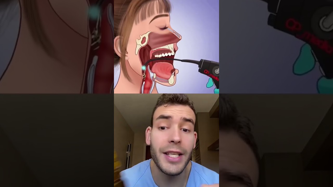 5 efectivas formas de quitar una raspa de la garganta de forma rápida y ...