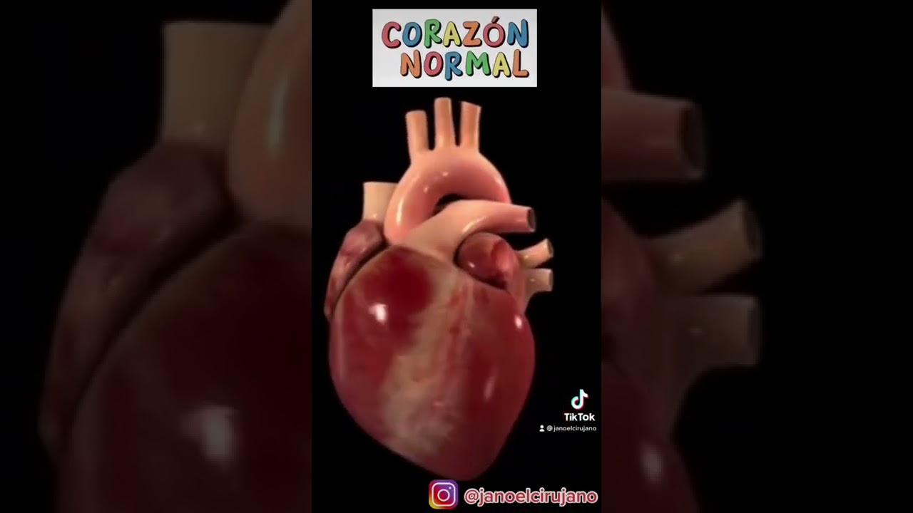 Descubre cómo se escucha un corazón sano: consejos para cuidar tu salud ...